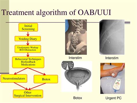 Ppt Neurogenic Bladder Powerpoint Presentation Free Download Id6299357