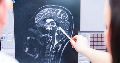 Radiopharm Theranostics Secures Pivotal Isotope For Cancer Targeting