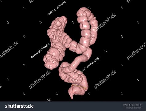 Ct Colonography Ct Colonography 3d Rendering Stock Illustration 2203801345 Shutterstock