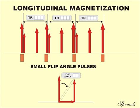 Magnetic Resonance Imaging