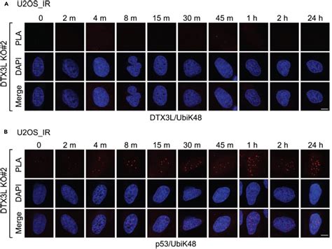 Dtx3l E3 Ligase Targets P53 For Degradation At Poly Adp Ribose