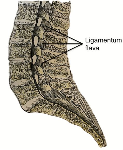 Ligamentum Flavum