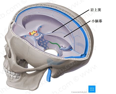 图解：小脑幕、岩上窦沟和岩上窦 脑医汇