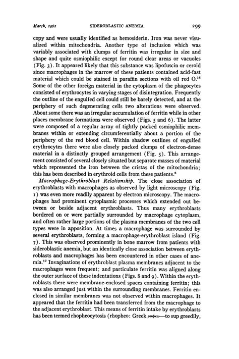 Electron Microscopic Observations Of Bone Marrow From Patients With