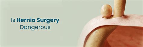 Is Hernia Surgery Dangerous Risks Recovery And Facts