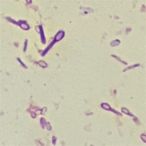 Throat Culture Gram Stain