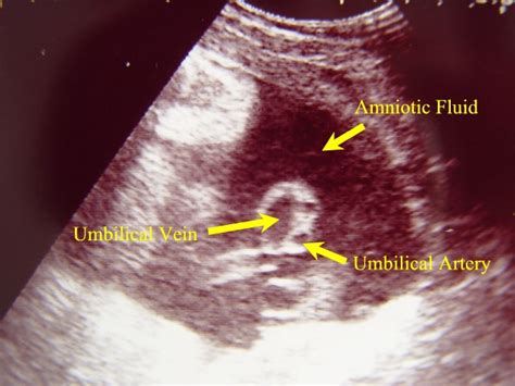 2nd And 3rd Trimester Ultrasound Scanning Military Obstetrics