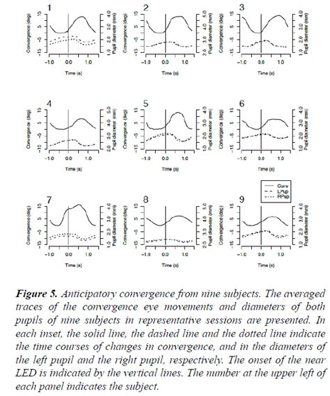 Dissociation Between The Onset Times Of Convergence Eye Movements And