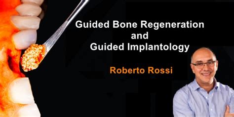 Guided Bone Regeneration And Guided Implantology Online Dental Library