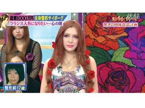 Vanilla Chamu Before And After