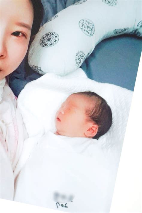 시카케어 제왕절개 흉터밴드 리뷰 및 사용법 네이버 블로그