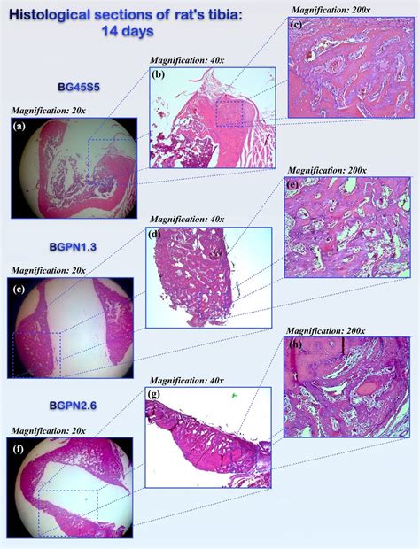 Micrographs Of Transversal Histological Sections Of Rat Tibia Tissues Download Scientific