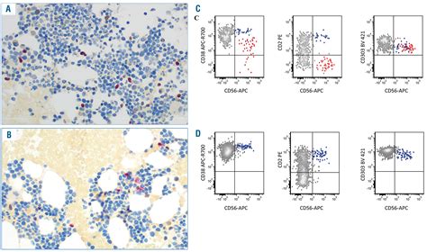 Immunophenotypic Characterization Of Reactive And Neoplastic Plasmacytoid Dendritic Cells
