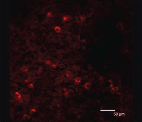 Facial Nucleus Double Fluorescent Labeling Laser Scanning Confocal