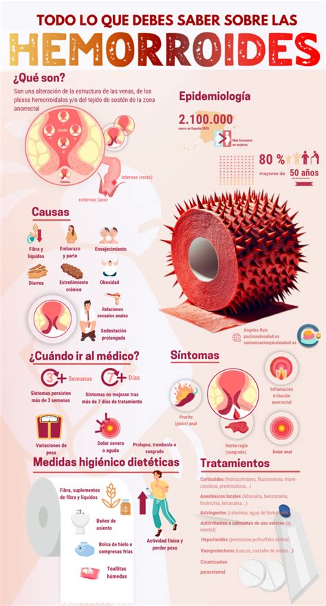 Hemorroides Todo Lo Que Debes Saber Pocimas De Salud