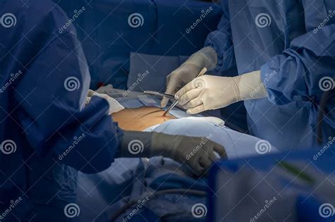 People Did Sensory Testing After General Anesthesia In Patient Undergo Abdominal Surgery Spinal
