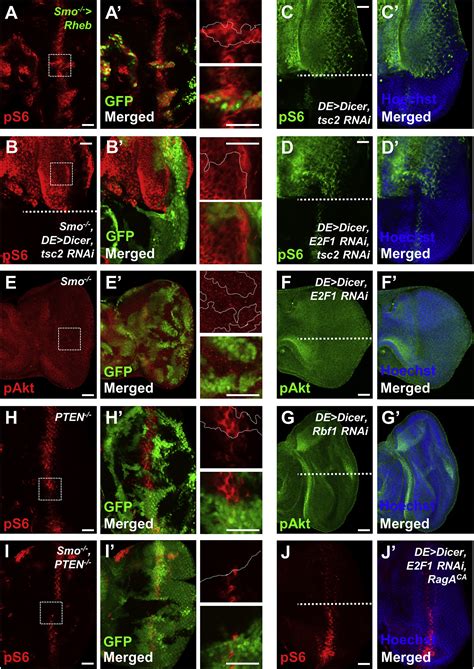 Spatial Activation Of Torc1 Is Regulated By Hedgehog And E2f1 Signaling