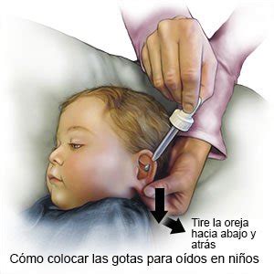 Cómo Utilizar Las Gotas Para Oídos En Niños Lo Que Necesita Saber