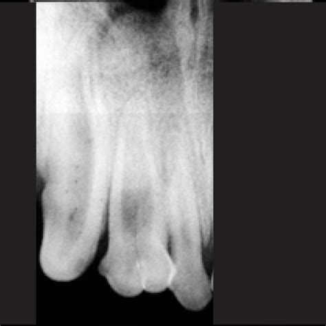 Pdf Teeth Abnormalities In The Dog