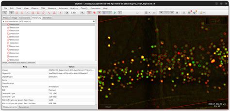 adding a new measurement in qupath table image analysis image sc forum