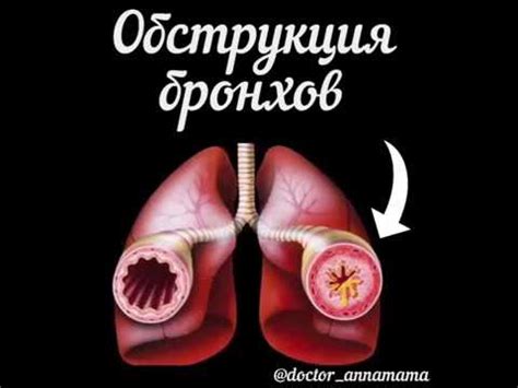 Обструкция бронхов - YouTube