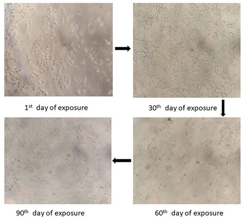 Jfb Free Full Text Curcumin Encapsulated Nanomicelles Improve Cellular Uptake And