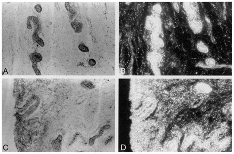 In Situ Hybridization Of Day 17 Pregnant Bovine Endometrium Deep