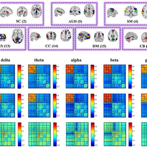 Pdf Building An Eeg Fmri Multi Modal Brain Graph A Concurrent Eeg