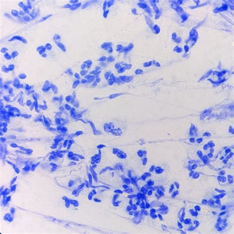 Hot Spot On The Skin Superficial Pyoderma Pittwater Animal Hospital