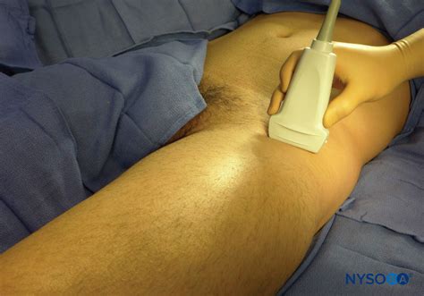 Lateral Femoral Cutaneous Nerve Injection