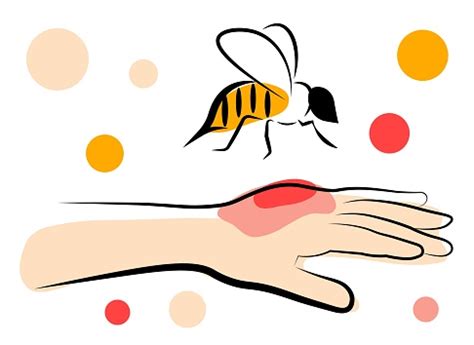 The Bee Bit Stock Illustration Download Image Now Bee Sting Bug
