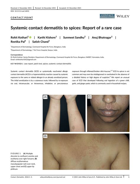 Pdf Systemic Contact Dermatitis To Spices Report Of A Rare Case