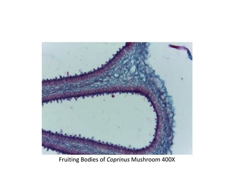 Coprinus Slide Basidium