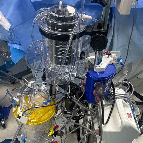 Normothermic Regional Perfusion Nrp Heartbeat Perfusion Solutions