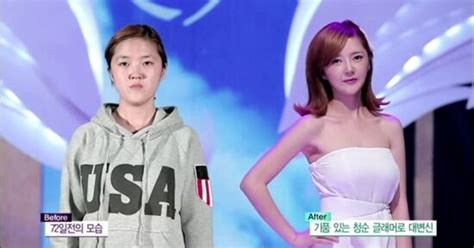 ‘렛미인3 출연 김은애 변신 후 ‘염정아가 따로 없네