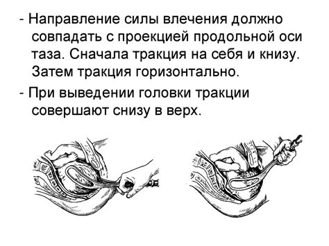 Акушерские операции - презентация онлайн