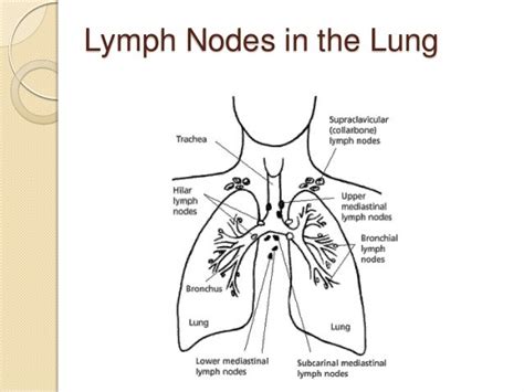 Lung Cancer Video1