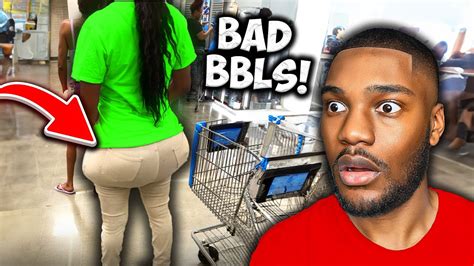 When Bbl Surgery Ruined Peoples Lives Youtube