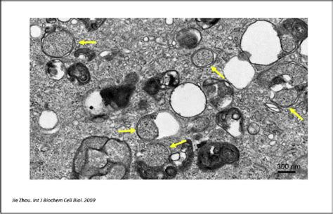 Electron Microscope View Download Scientific Diagram