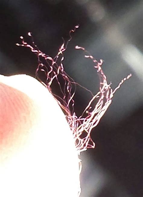 Fibers Disease