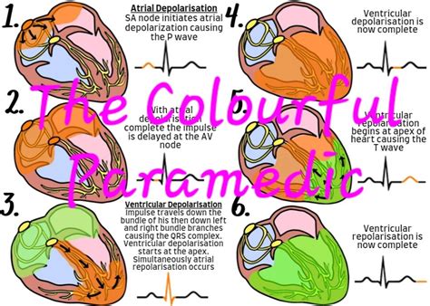 The Three Lead Ecg Guide Part One Etsy