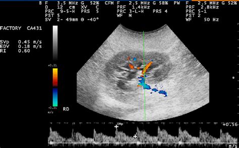 Normal Resistivity Index 0 60 And Spectral Trace Of The Interlobar Download Scientific