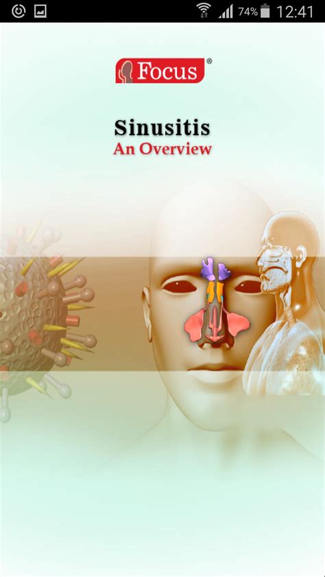 Descargar Sinusitis Apk Última Versión 101 Para Android