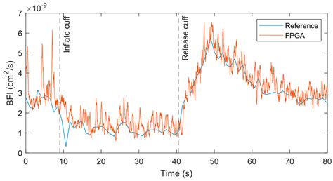 A Device On Chip Solution For Real Time Diffuse Correlation