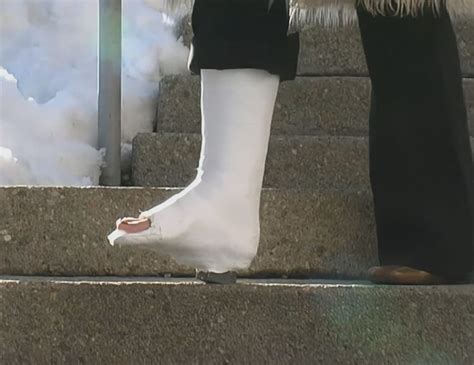 Pin By Mry Markay On Gips Leg Cast Film Inspiration It Cast