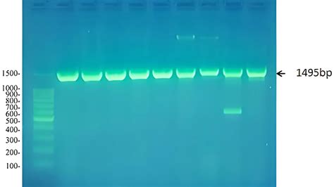 Figure 1 Amplicons Of 16s Rrna Gene Amplified Using Universal 16s Rrna Primers Distribution