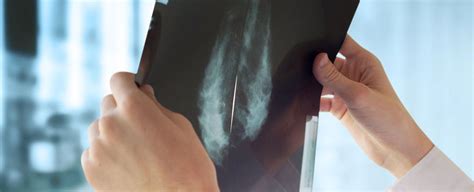 Largest Ever Analysis Of Breast Cancer Genomes Could Lead To Personalised Treatments Sciencealert