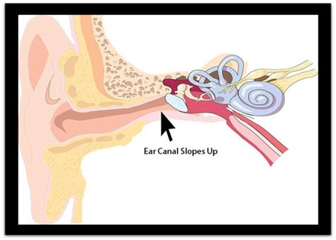 9 Bad Problems Caused By Dangerous Ear Qtips Dr Momma Says