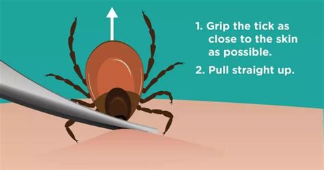 Insect Bites Treatment And Prevention Sponsored By Pharmasave Insect Bites Treatment And Prevention Sponsored By Pharmasave