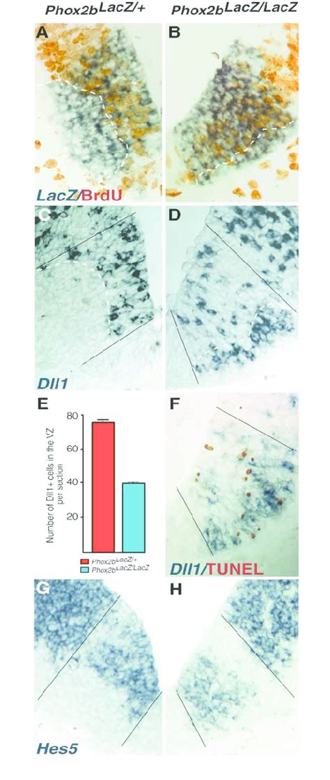 Defective Generation Of Post Mitotic Motor Neurons In The Ventricular